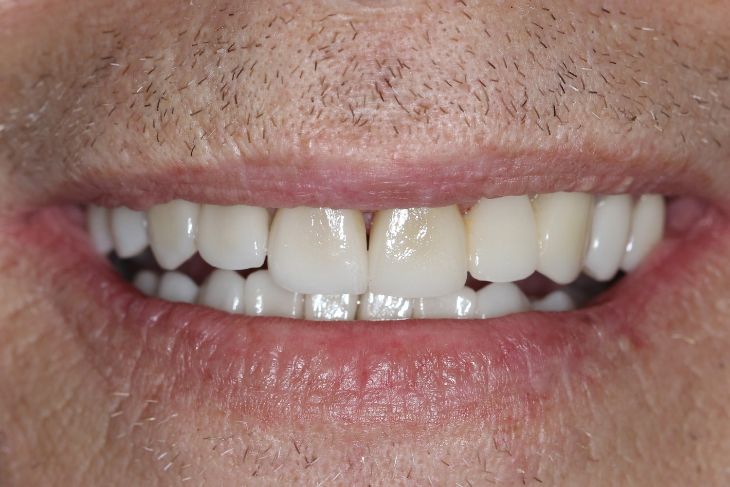 Gallery - Dental Solutions