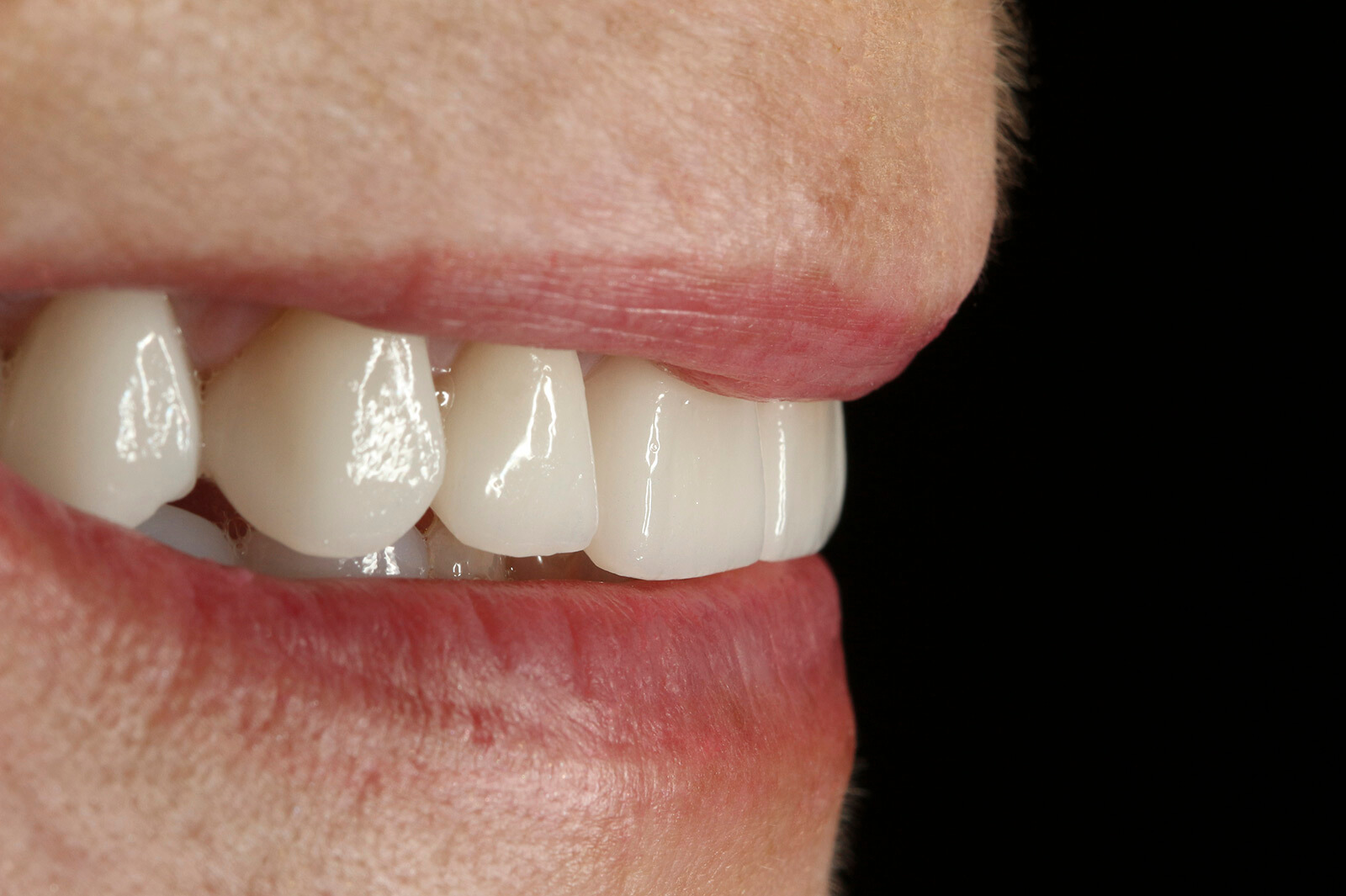 Smile Design - Dental Solutions