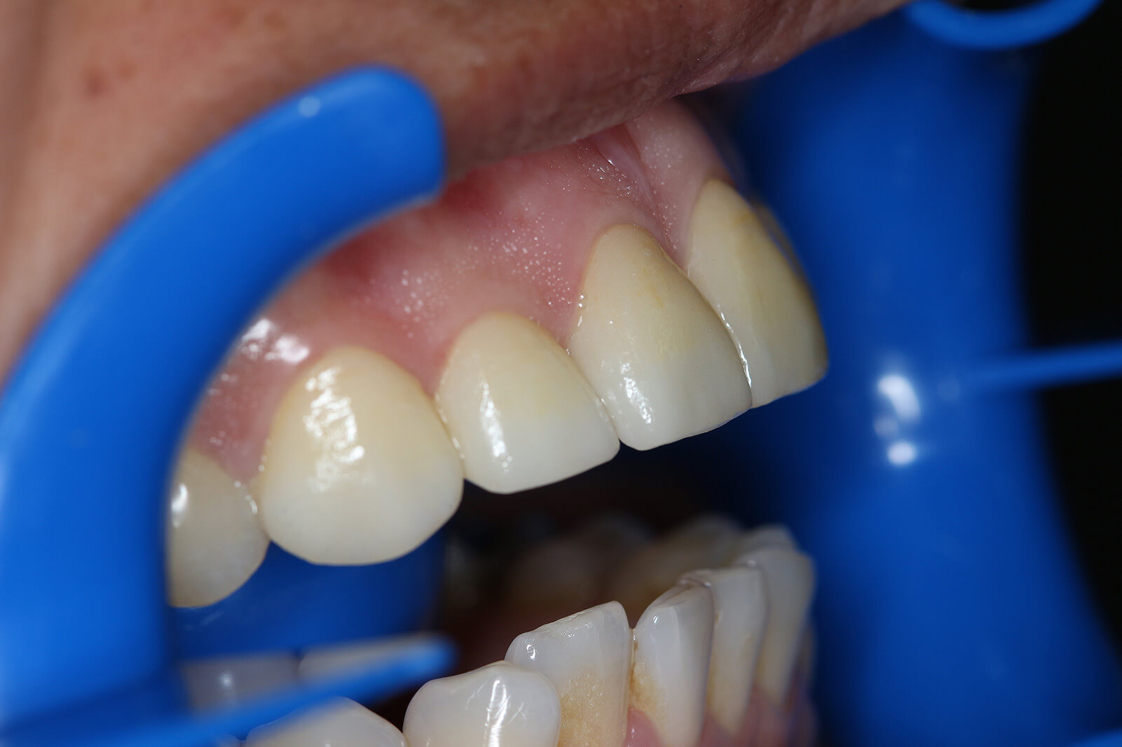 Gallery - Dental Solutions