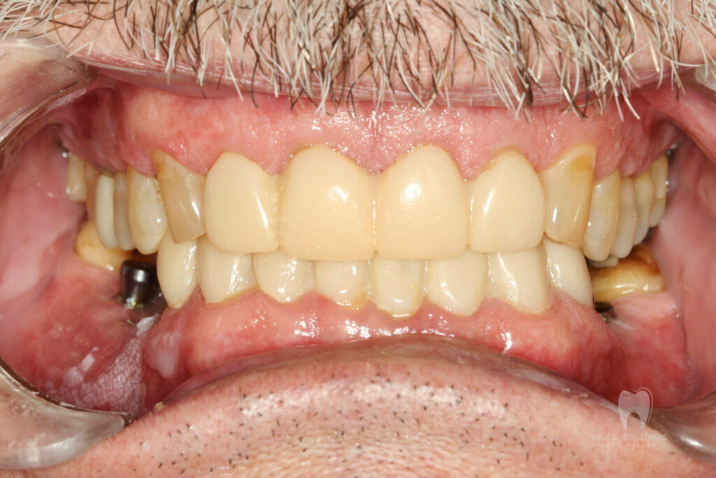 Another chance for your teeth! Dental Treatment - Dental Solutions