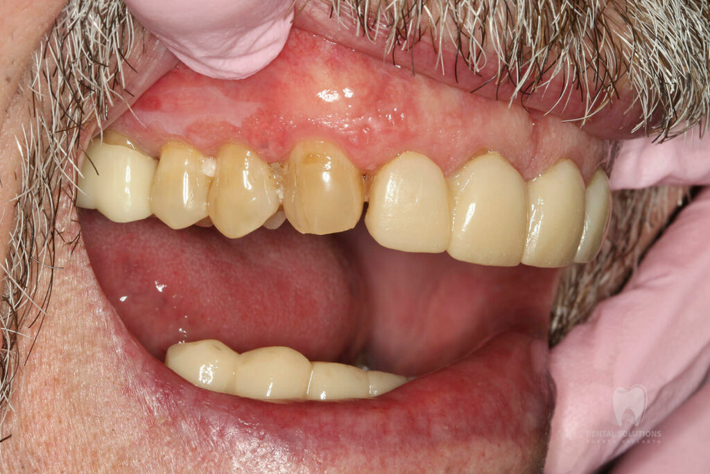 Another chance for your teeth! Dental Treatment - Dental Solutions